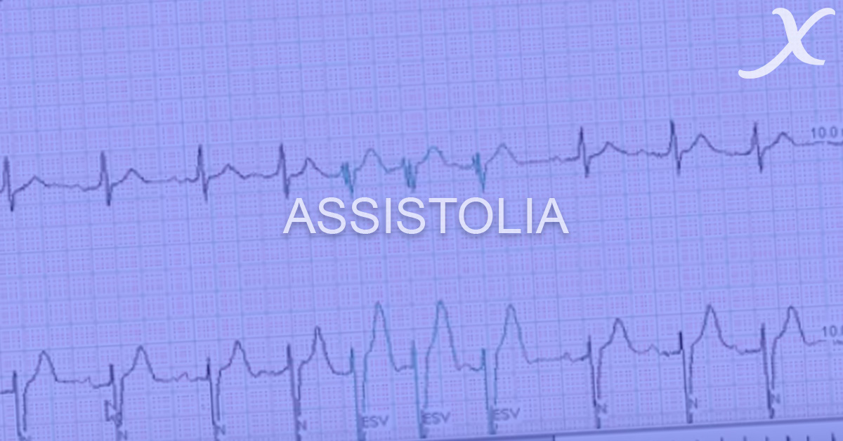 ASSISTOLIA - TME - Telemedicina Cardiológica