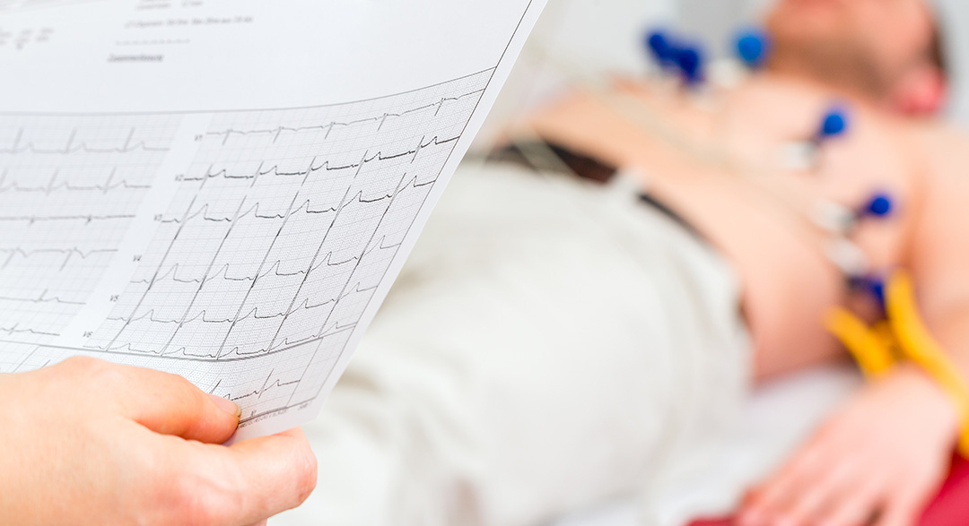Aparelho de ECG: Como funciona o eletrocardiograma? - TME ...
